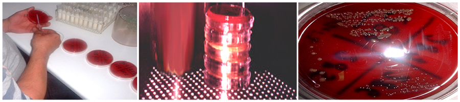 Pruebas y Métodos para el Diagnóstico de Mastitis II - BM Editores